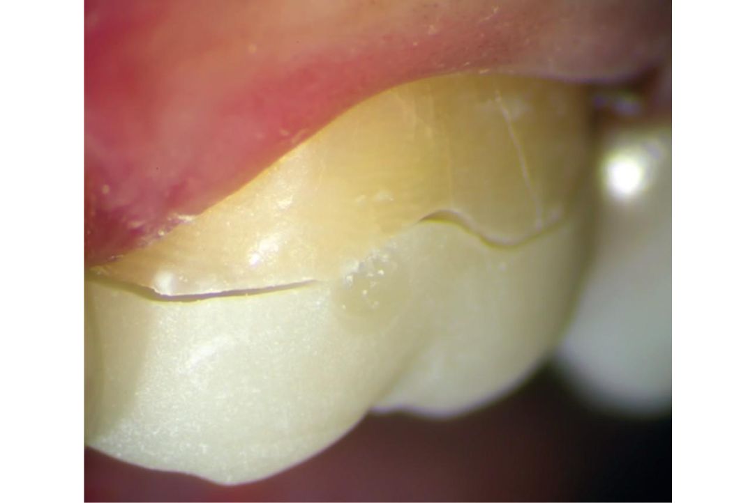 Microscop Stomatologic Leica M320 High End 4K - HTP.ro