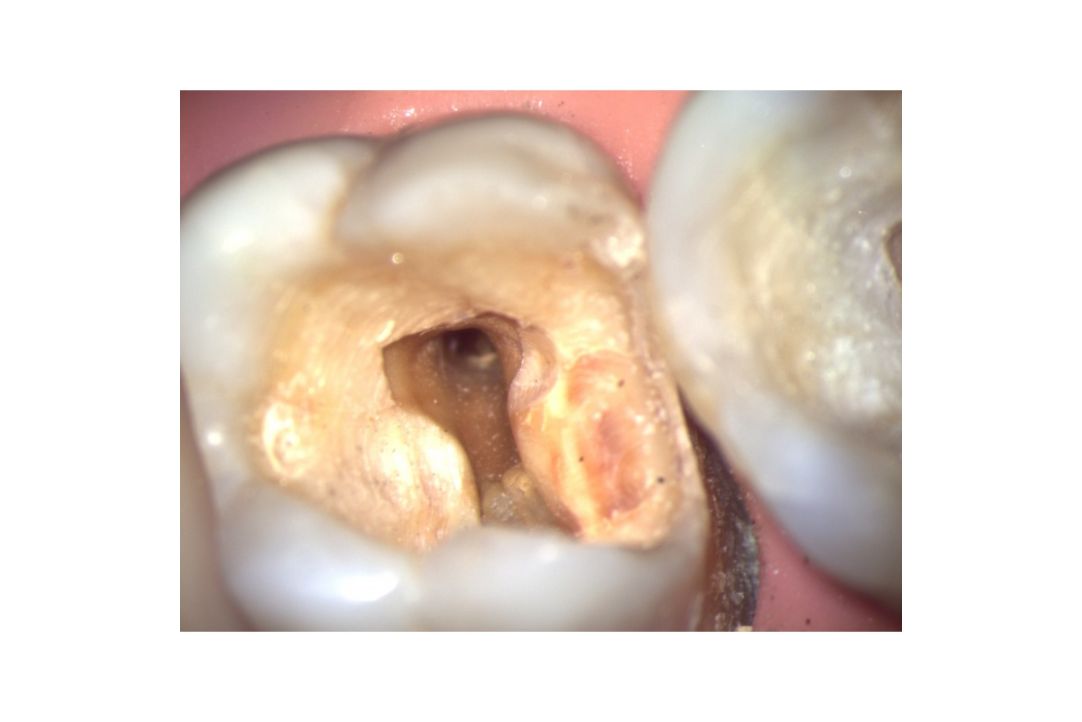 Microscop Stomatologic Leica M320 High End 4K - HTP.ro